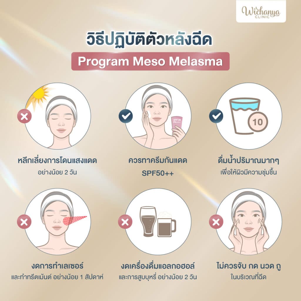 Meso Melasma ฉีดเมโสฝ้า แก้ปัญหาฝ้าที่กวนใจได้ผลลัพธ์ที่ชัดเจน